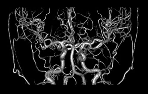 fig.1