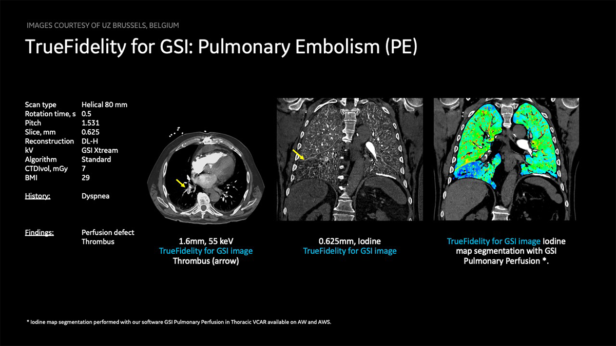 GE Healthcare