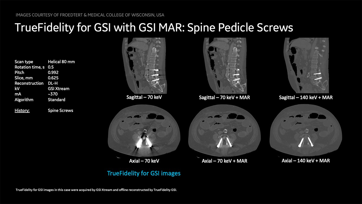 GE HealthCare | TrueFidelity for GSI Images