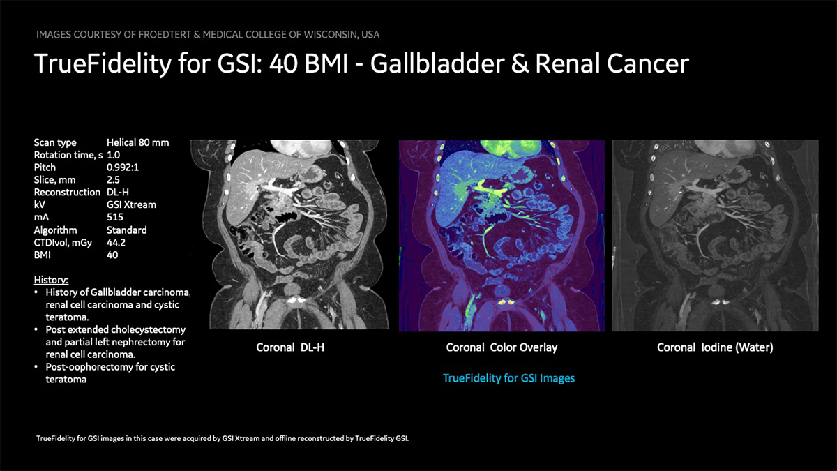 GE HealthCare | TrueFidelity for GSI Images