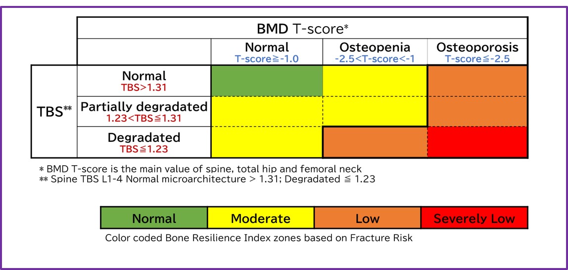 Trabecular Bone Score (TBS)の概要 国保野上厚生総合病院 整形外科 診療部長 松本 卓二 先生