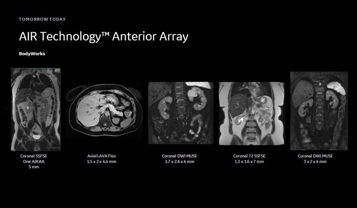 SIGNA Artist Lift: GE Healthcare