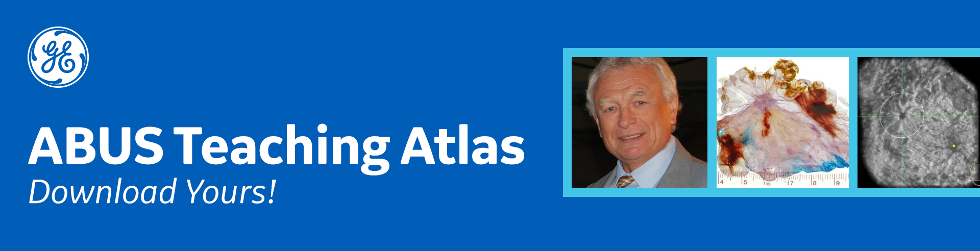ABUS Teaching Atlas