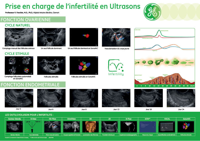 Prise en charge de l’infertilité