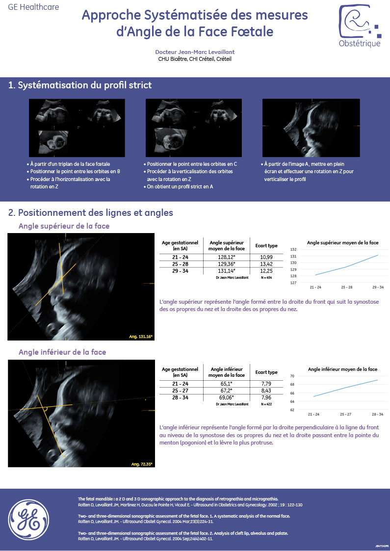 Angles de la face fœtale