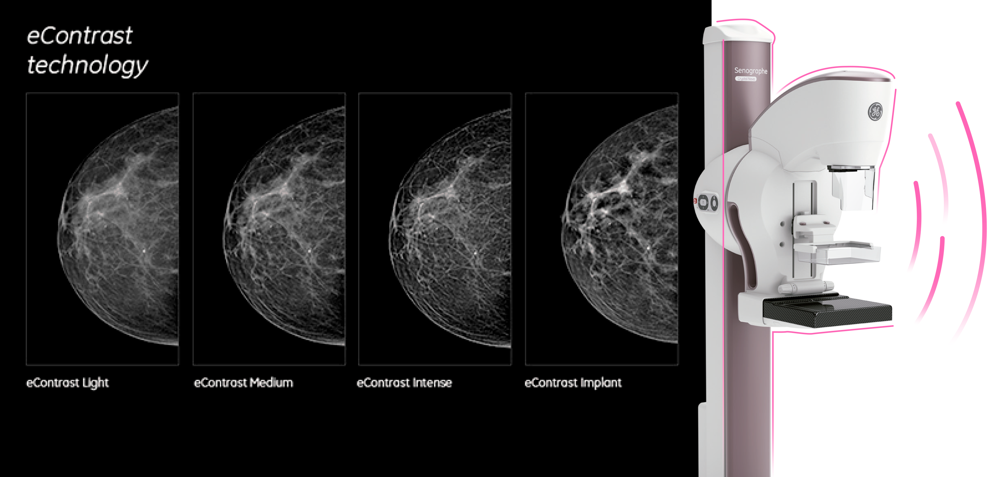 Mamógrafo Senographe Nova | GE Healthcare