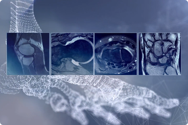 GE Healthcare Isokinetic